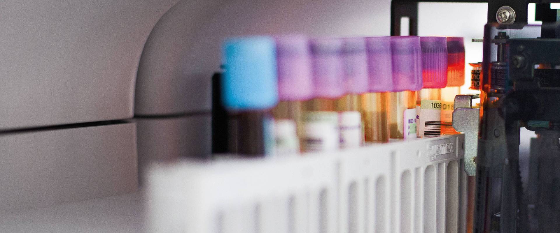 Allergiediagnostik | amedes Hamburg